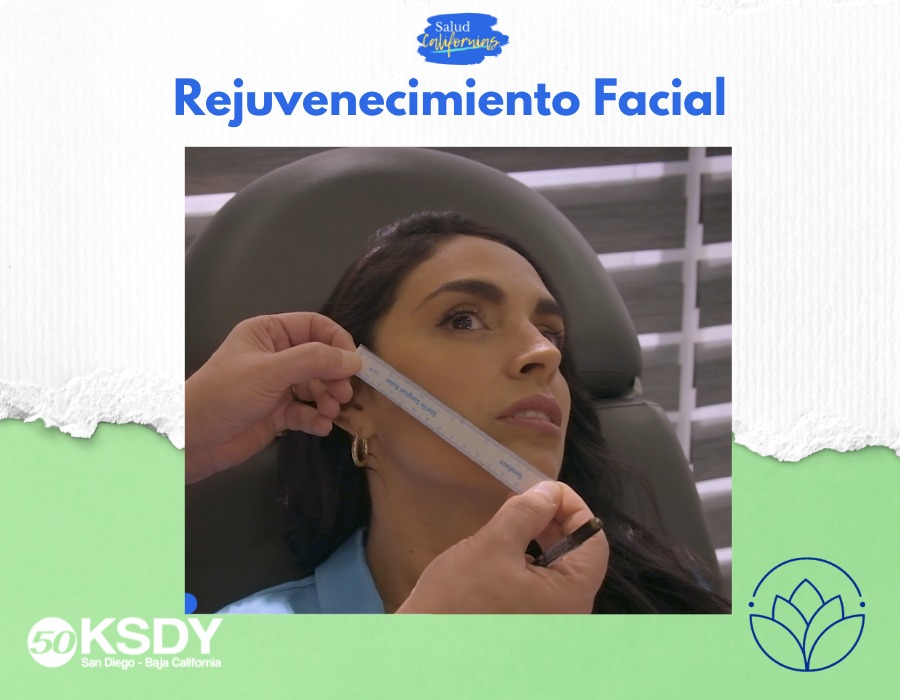 Rejuvenecimiento Facial con Renovo Health and Beauty - KSDY Canal 50 ...